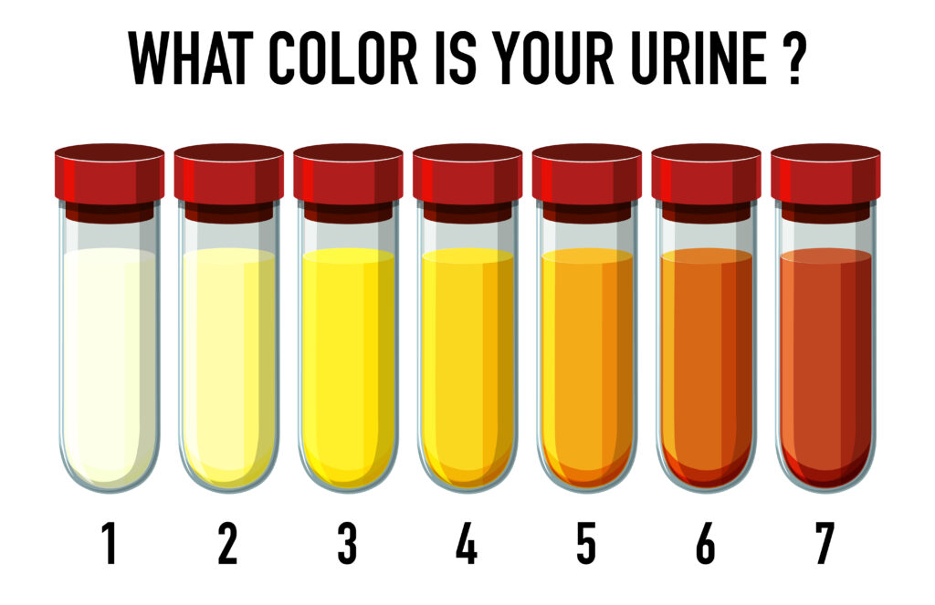 What Is The Normal Urine Color THE SOURCE what-is-the-normal-urine-color-the-source
